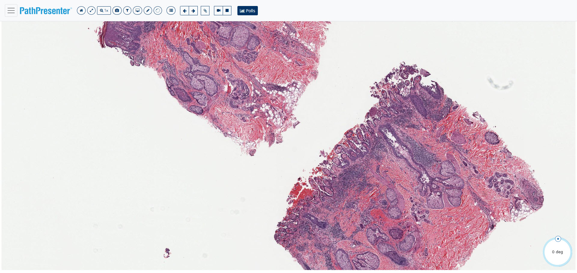 Dermatopathology Review: Case #11 | PathPresenter