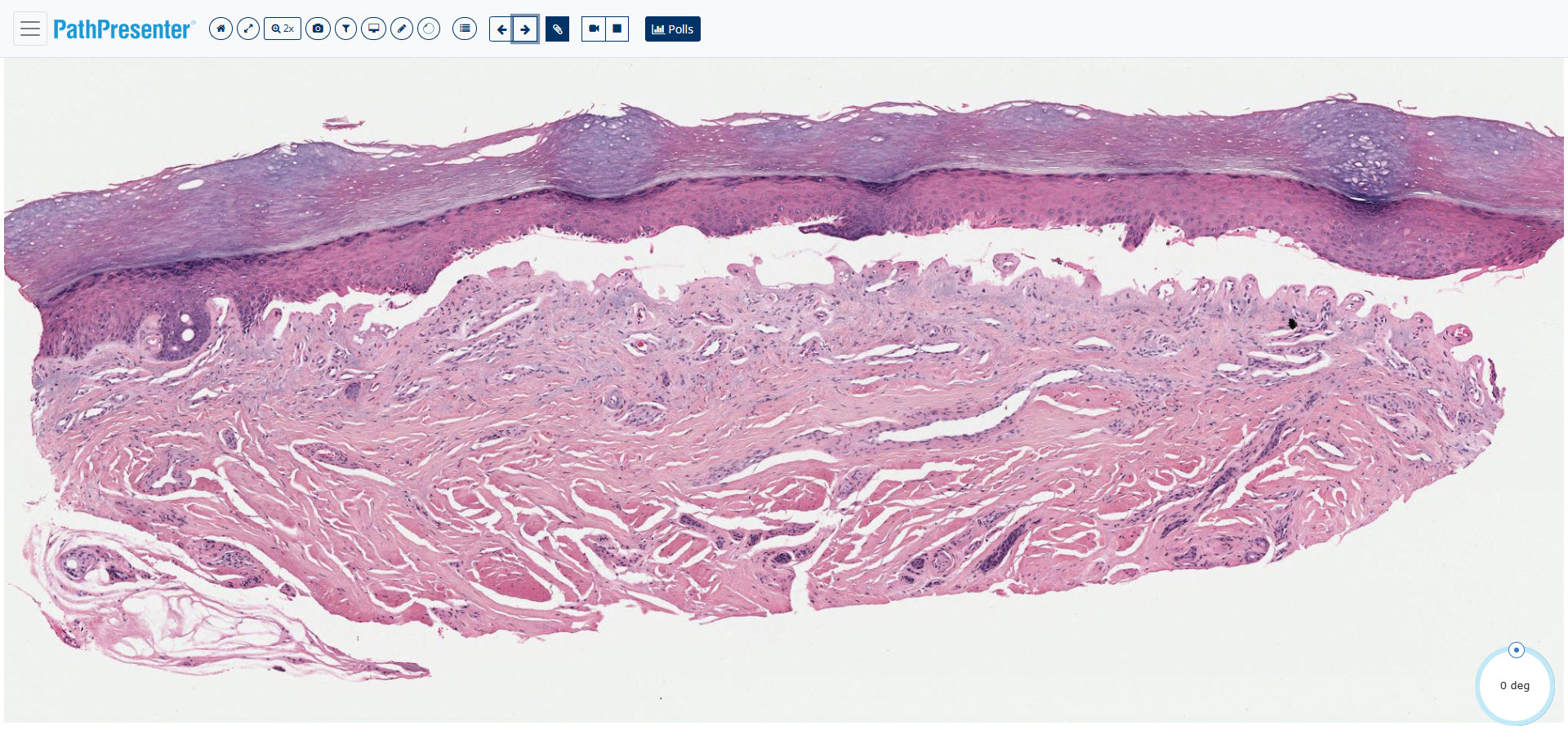 Dermatopathology Review: Case #14 | PathPresenter